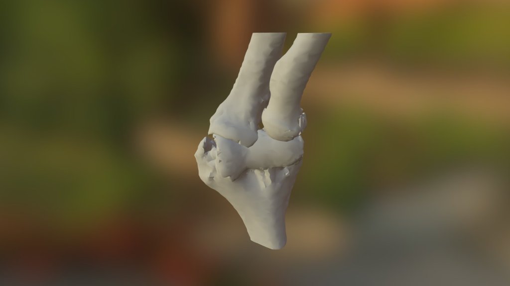 Elbow - post traumatic - 3D model by orto3d [ff55843] - Sketchfab