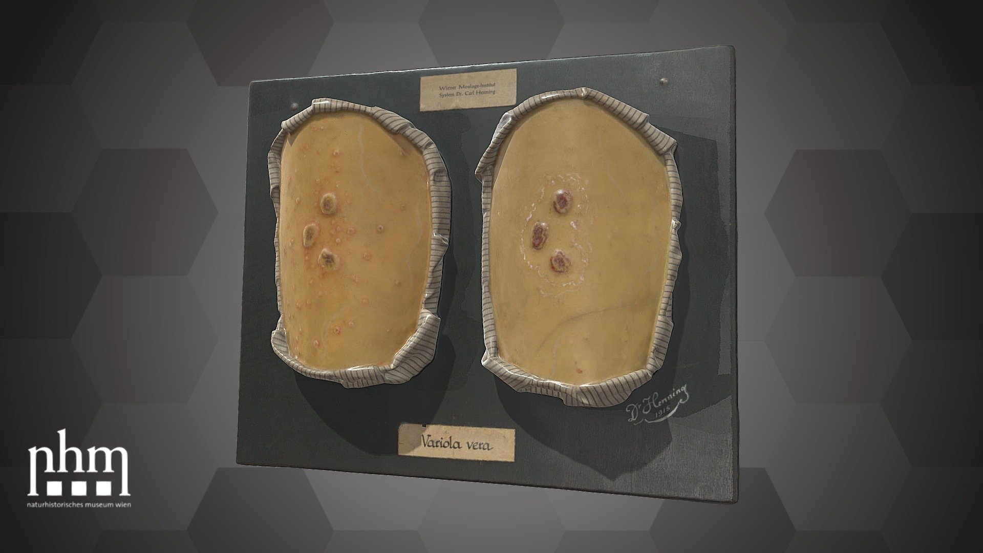 Variola vera - 3D model by Natural History Museum Vienna (@NHMWien ...