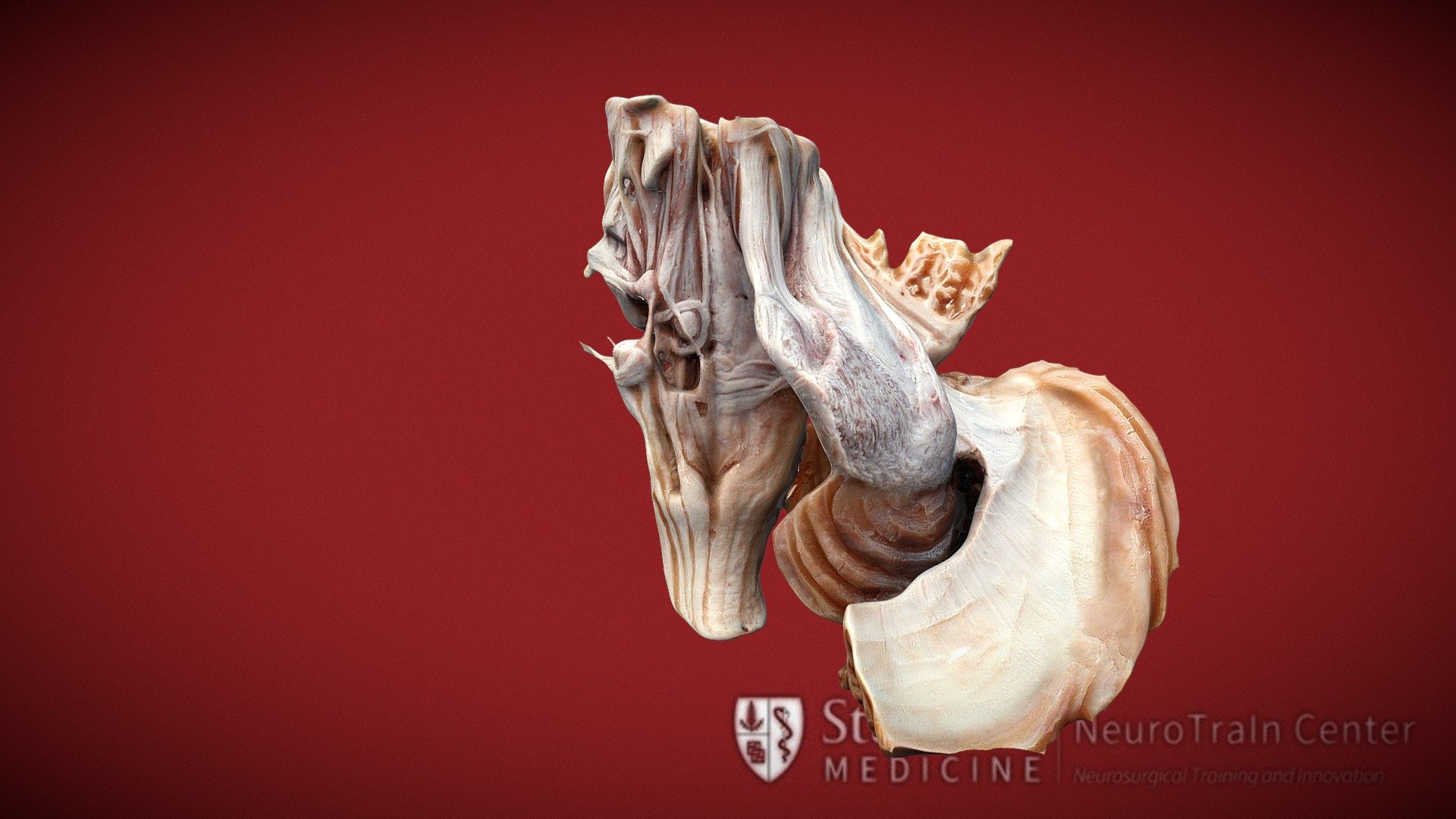 Fourth Ventricle floor WM - 3D model by vv (@verav) [ffaaf0c] - Sketchfab